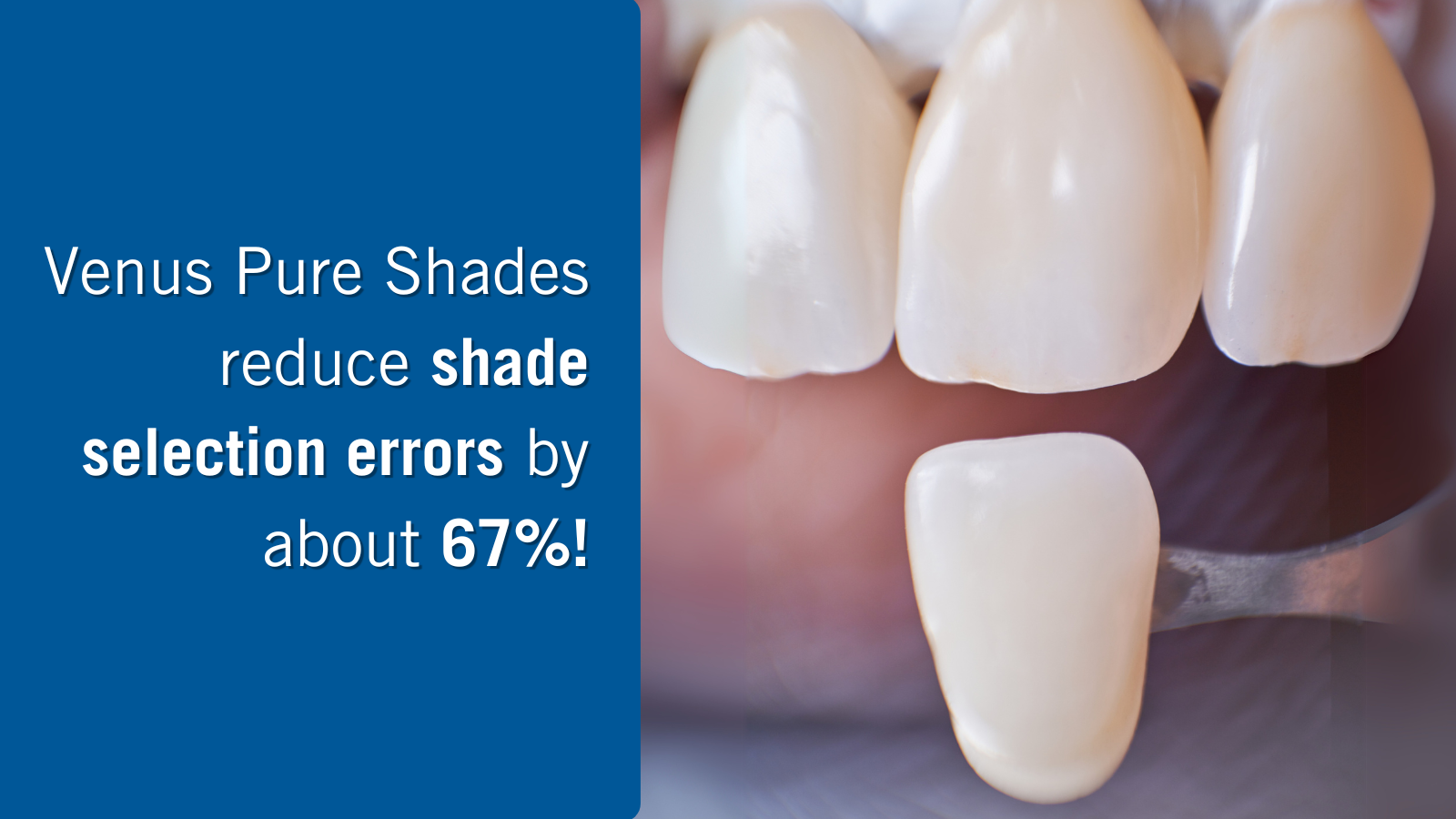 Study confirms: simplified layering, pleasing results