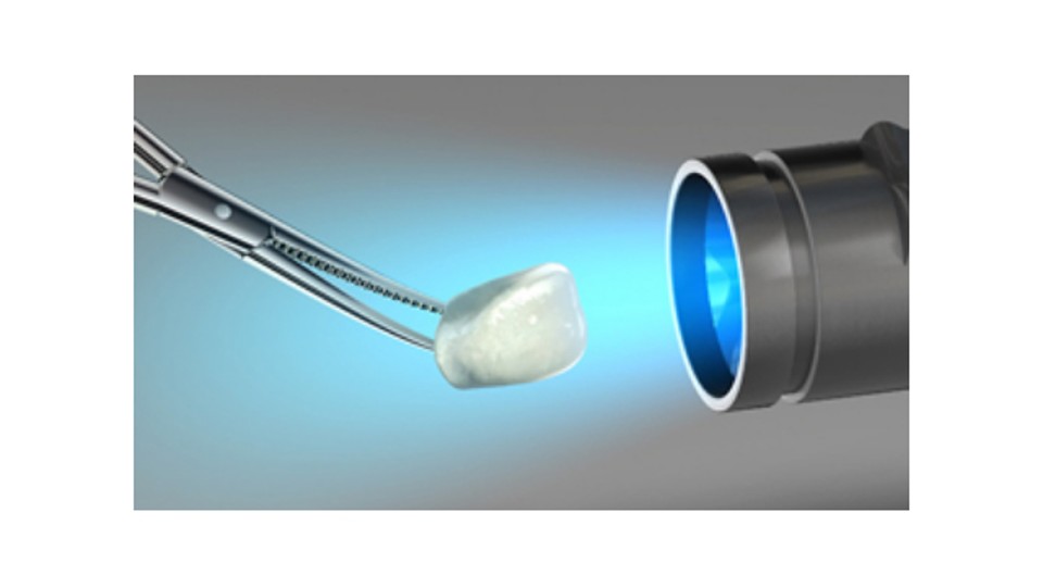 Light Polymerization Device