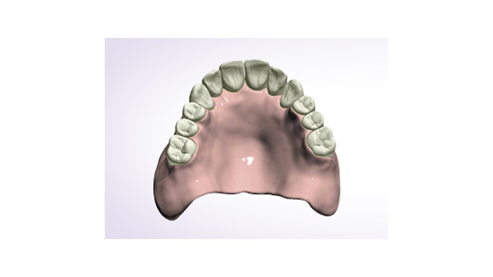 3Shape Dental System