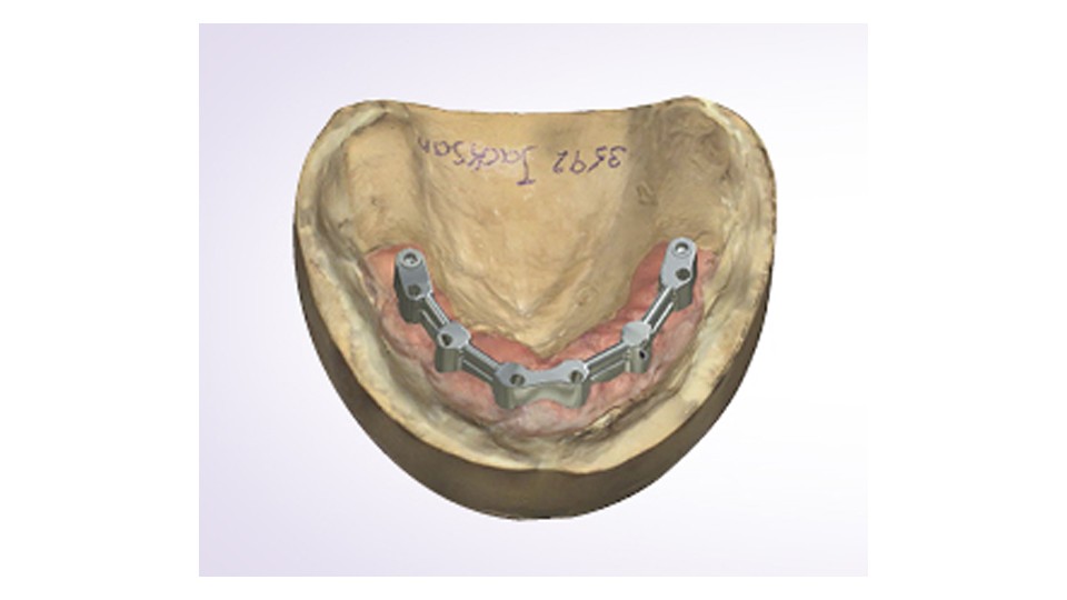 3Shape Dental System