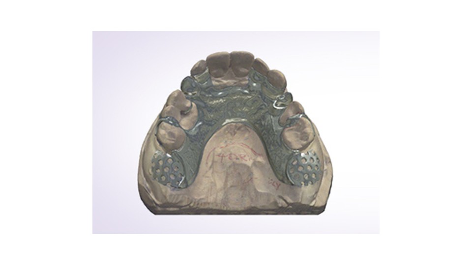 3Shape Dental System