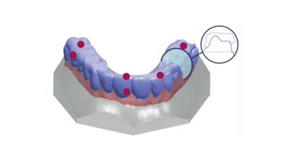 3Shape Dental System