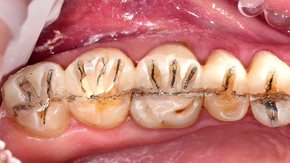 Charisma® Bulk Flow ONE