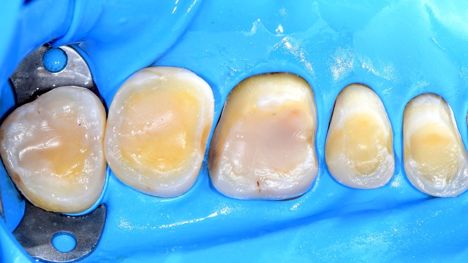 Charisma® Bulk Flow ONE