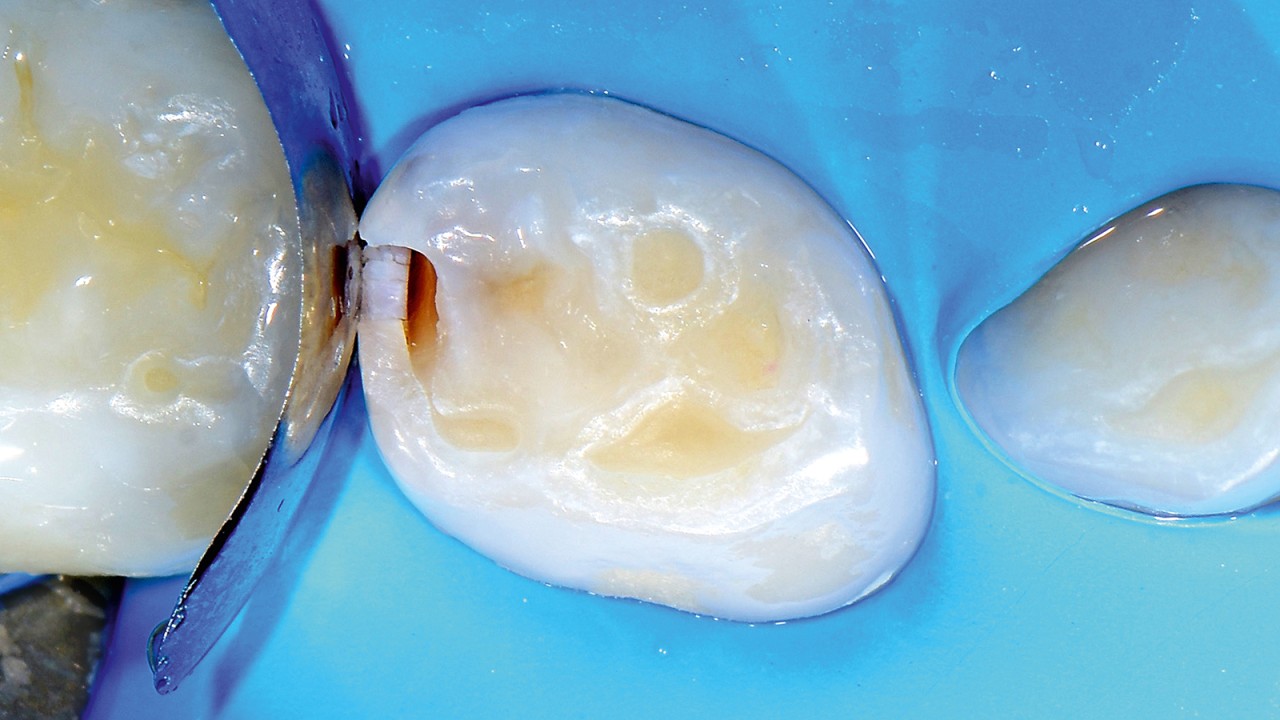 Charisma® Bulk Flow ONE