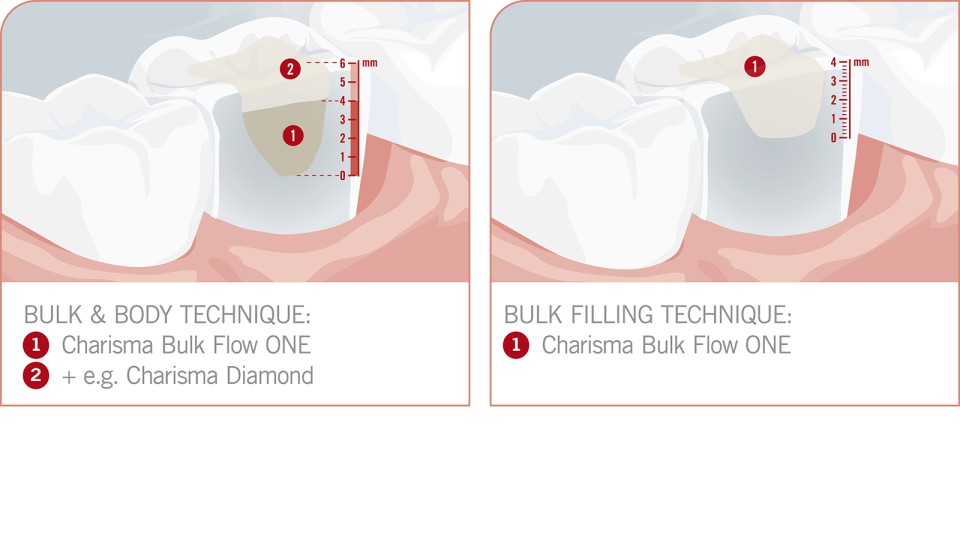 Charisma® Bulk Flow ONE