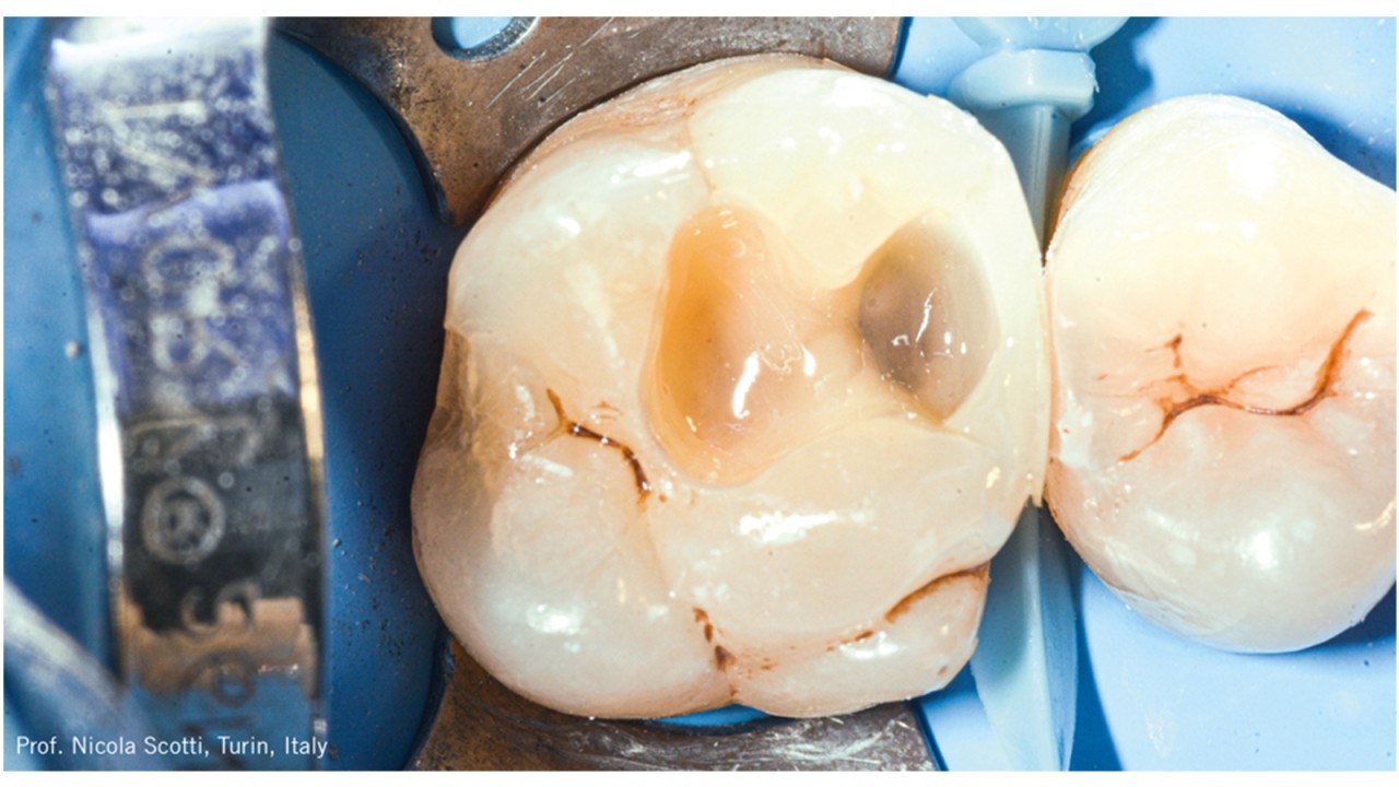 Charisma® Diamond/Topaz ONE