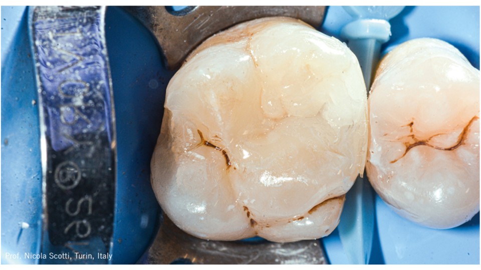 Charisma® Diamond/Topaz ONE