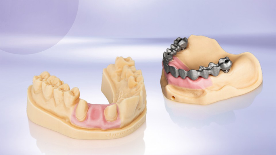 dima Print Gingiva Mask – 3D gingiva resin