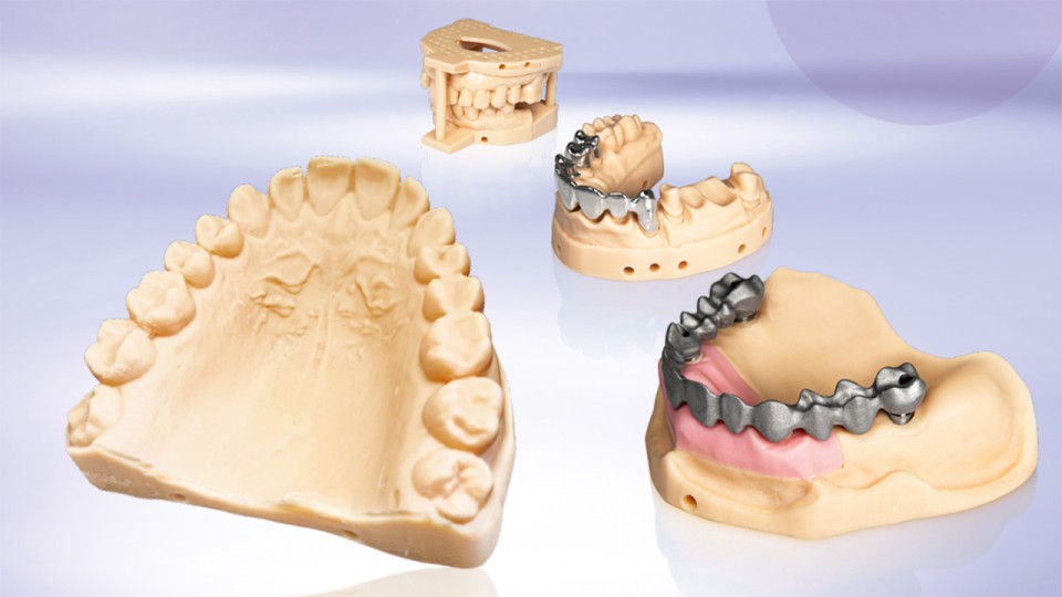 dima Print Stone beige – 3D dental model resin