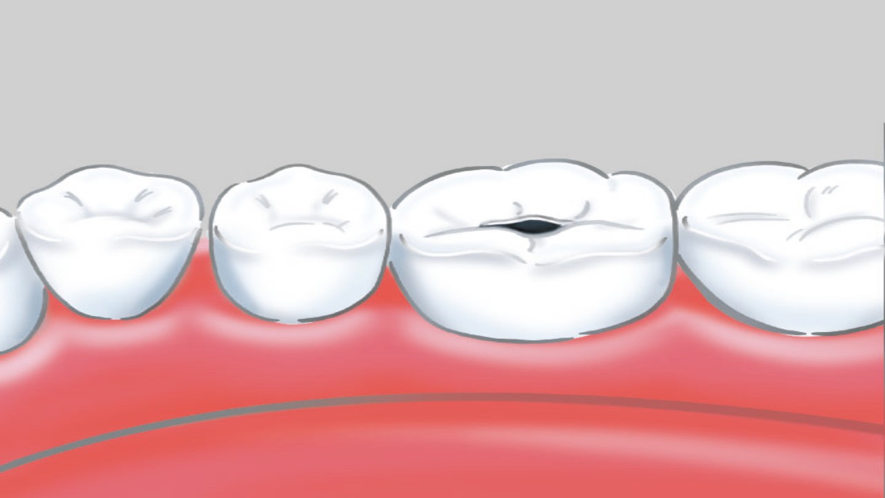 MEMOSIL 2 - the expert for special indications