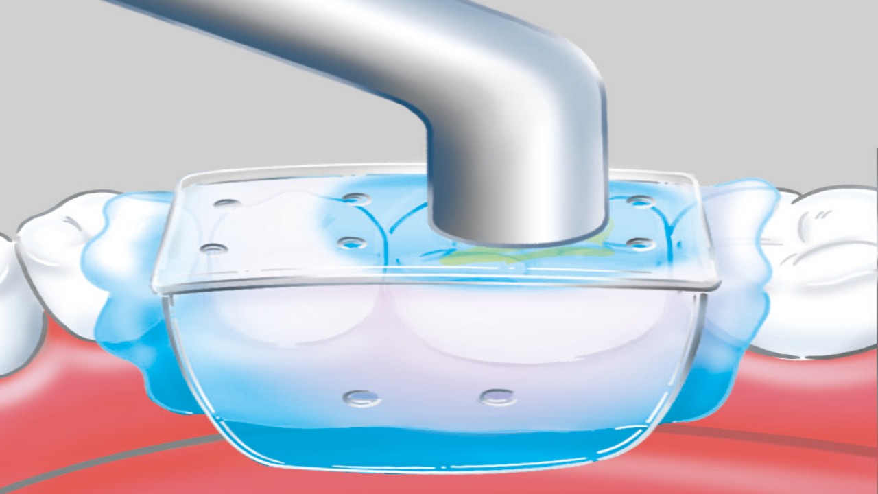 MEMOSIL 2 - the expert for special indications