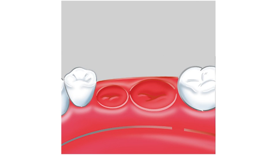 MEMOSIL 2 - the expert for special indications