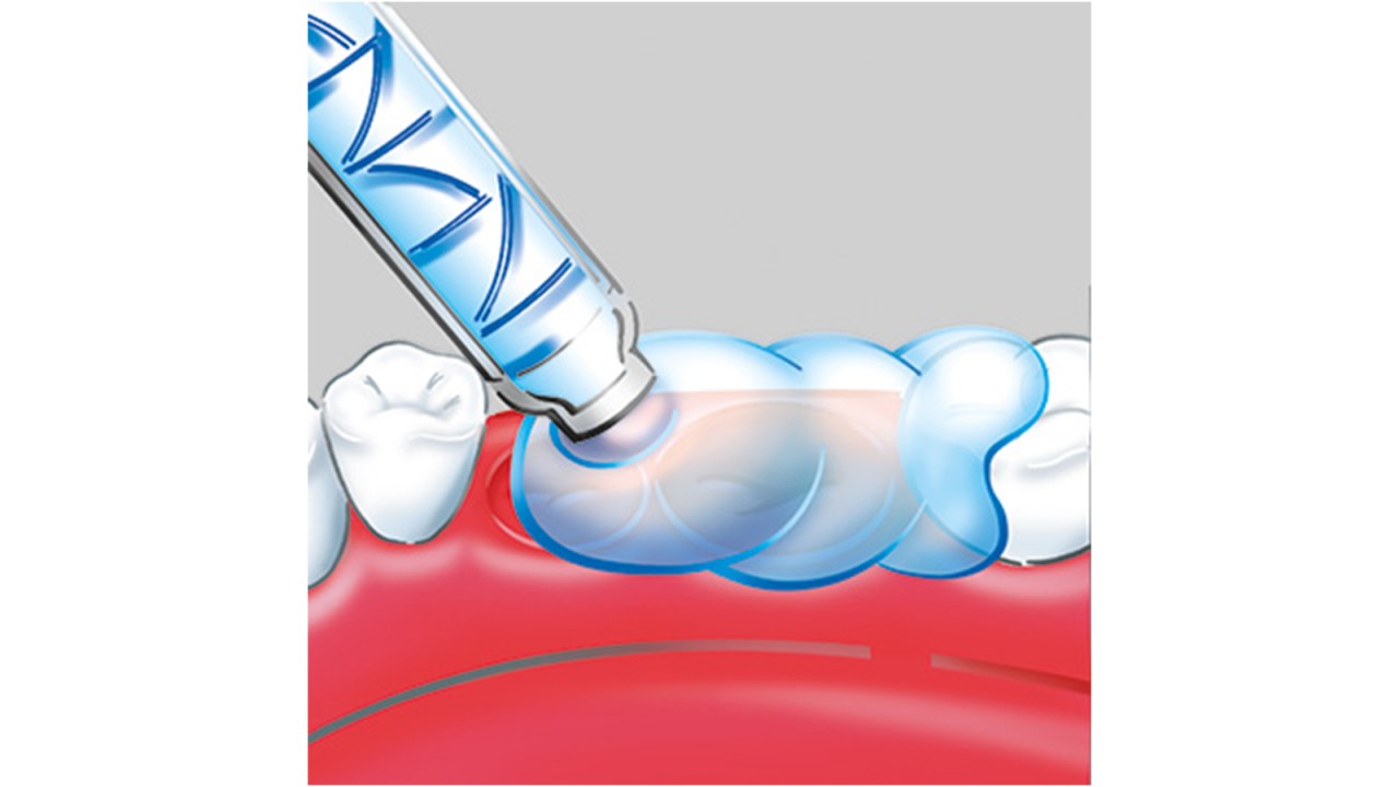 MEMOSIL 2 - the expert for special indications