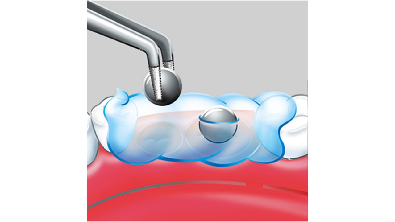MEMOSIL 2 - the expert for special indications