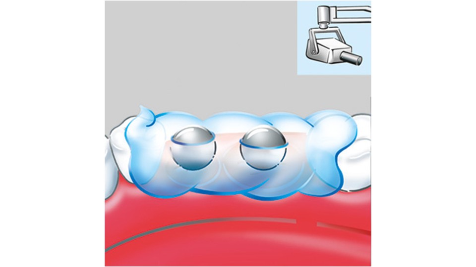 MEMOSIL 2 - the expert for special indications