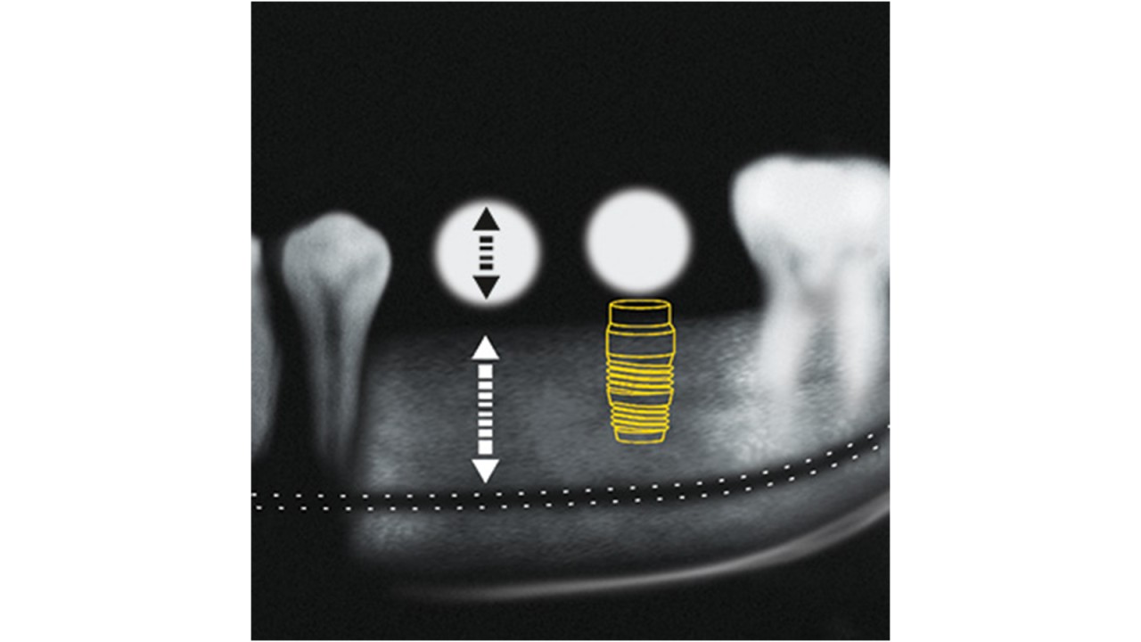MEMOSIL 2 - the expert for special indications