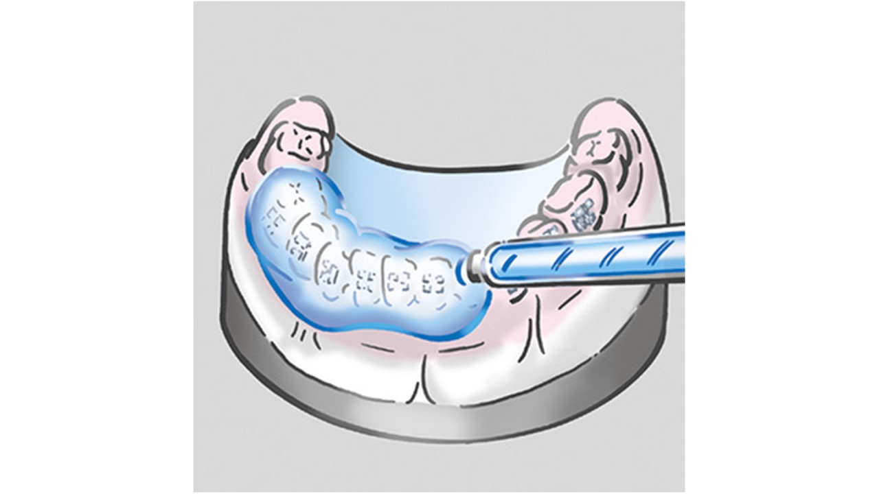 MEMOSIL 2 - the expert for special indications