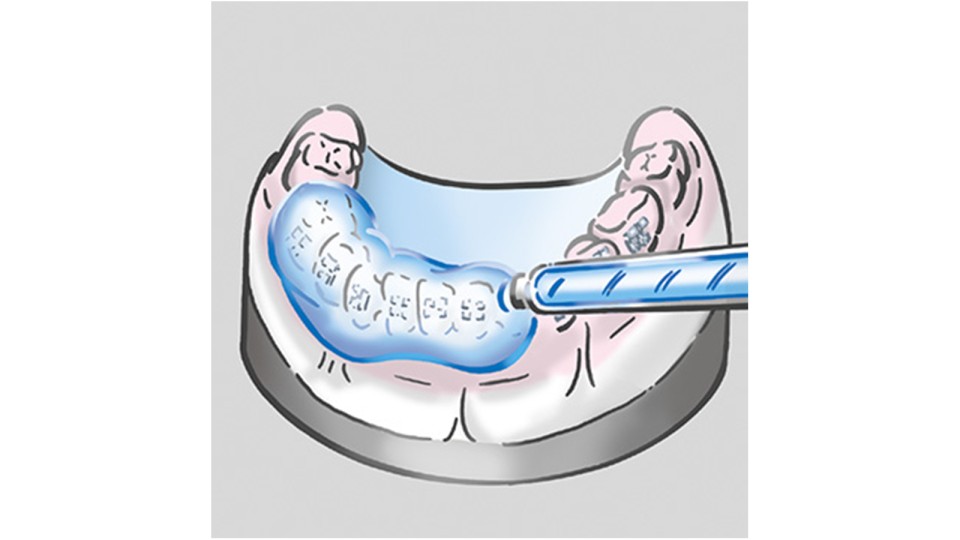 MEMOSIL 2 - the expert for special indications