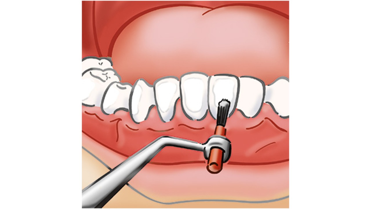 MEMOSIL 2 - the expert for special indications