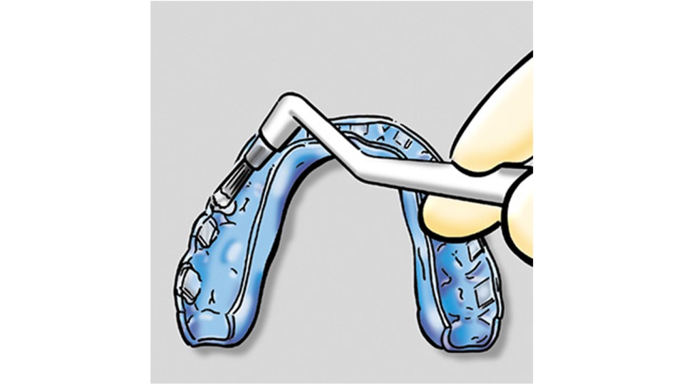 MEMOSIL 2 - the expert for special indications