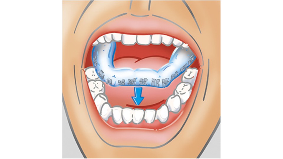 MEMOSIL 2 - the expert for special indications