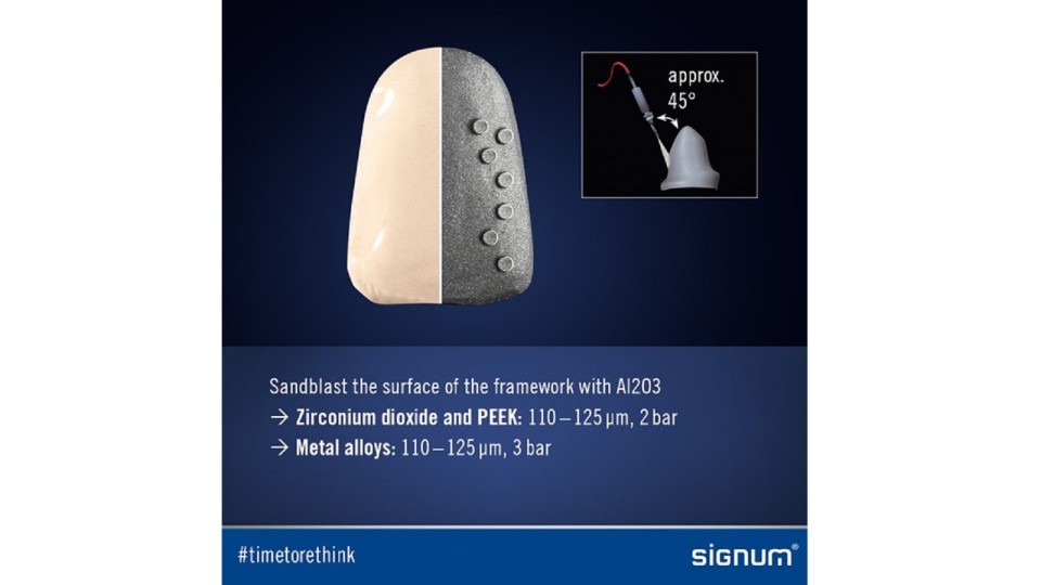 Signum® universal bond