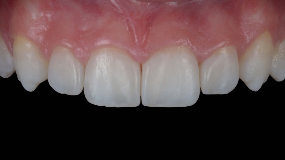 Venus® Pearl Pure Shades