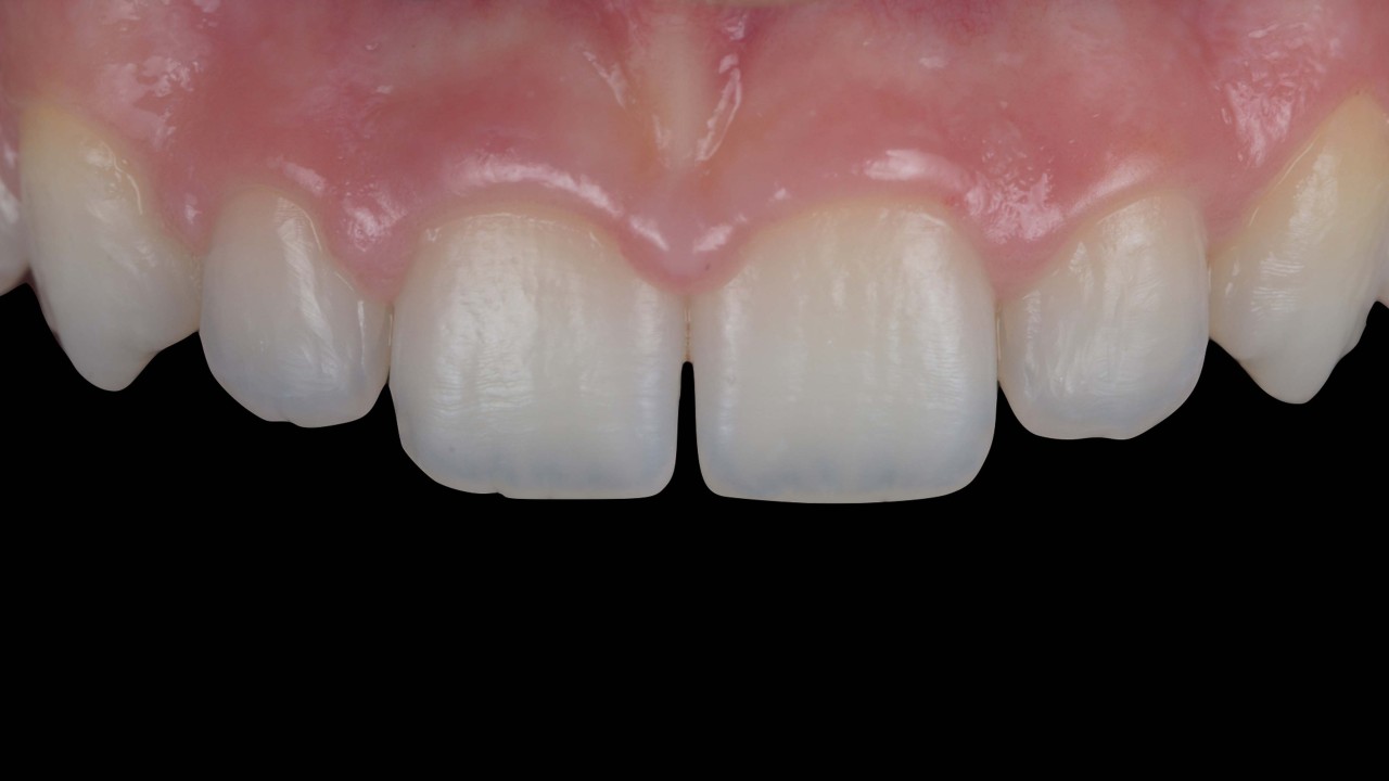 Venus® Pearl Pure Shades