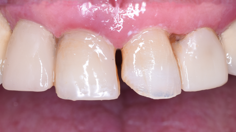 Be part of the Venus community