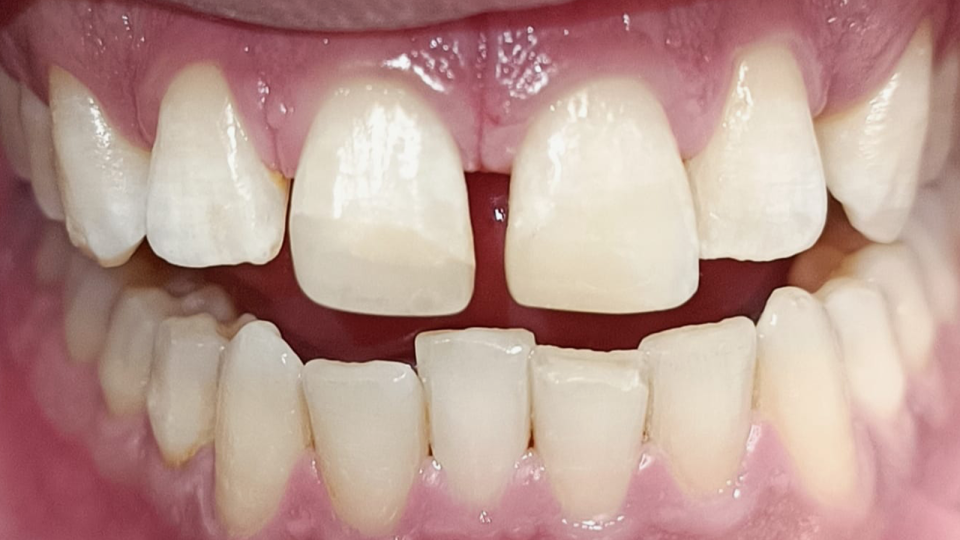 Be part of the Venus community