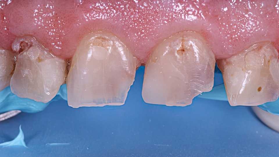 Venus® Pearl Pure Shades