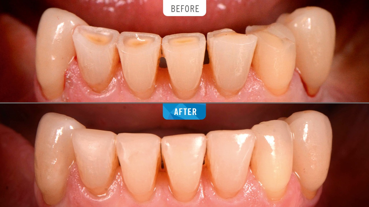 Venus® Diamond/Pearl Pure Shades